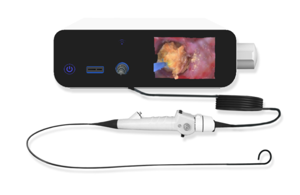 Viziscope – Making Endoscope Affordable
